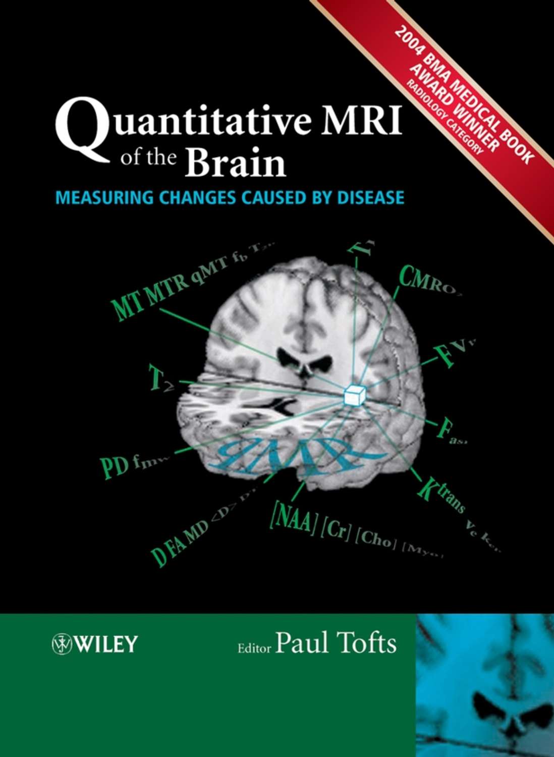 «Quantitative MRI of the Brain», – скачать pdf на Литрес